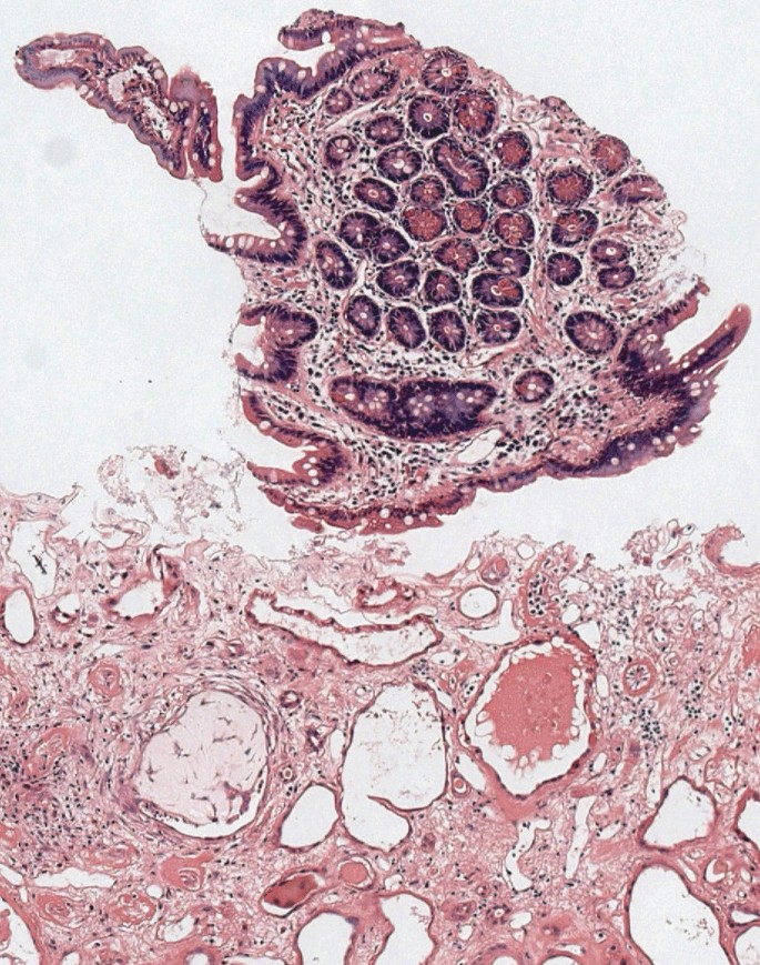 How to Look at a Renal Biopsy Specimen: Preliminary Study | SpringerLink