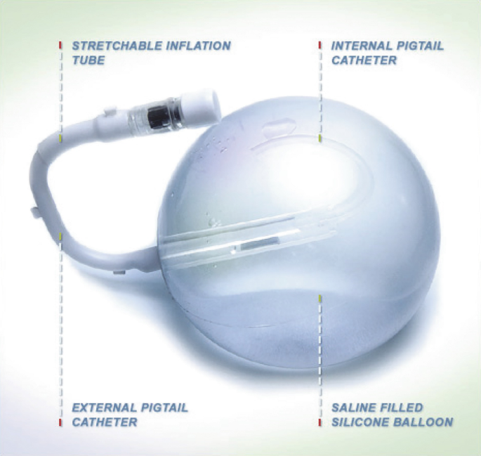 Intragastric Balloons | SpringerLink