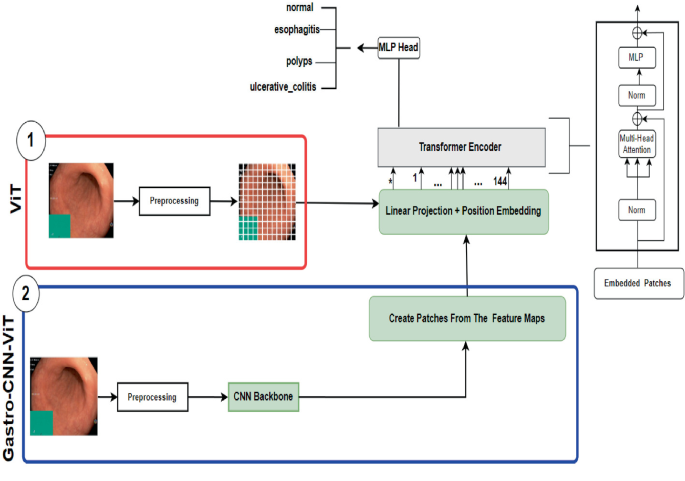 Gastro-CNN-VIT: Vision Transformer and Deep CNNs for Detecting GI ...