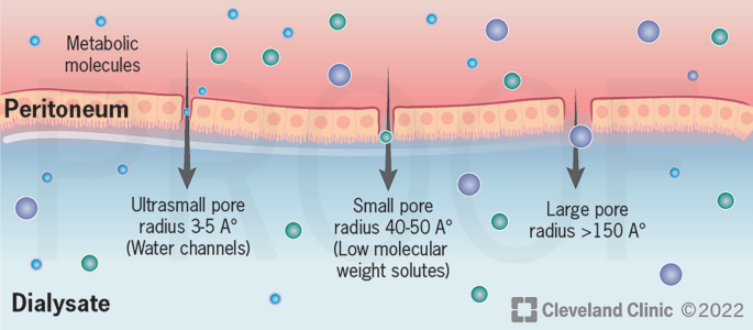 Principles of Hemo- and Peritoneal Dialysis | SpringerLink