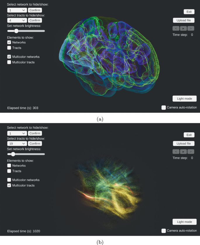Brain Visualizer: A Tool for EEG Data Processing and 3D Brain Activity Visualization | SpringerLink