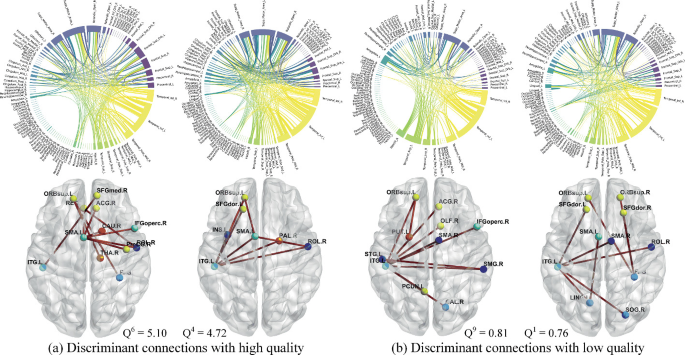 Quality-Aware Fuzzy Min-Max Neural Networks for Dynamic Brain Network ...