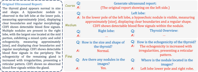 Design as Desired: Utilizing Visual Question Answering for Multimodal Pre-training | Springer ...
