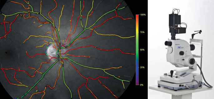 Retinal Oximetry in Central Nervous System Diseases | SpringerLink