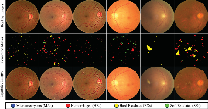 Diversified and Structure-Realistic Fundus Image Synthesis for Diabetic ...