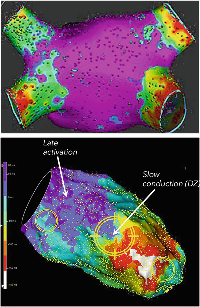Cardiac Mapping Technologies | SpringerLink