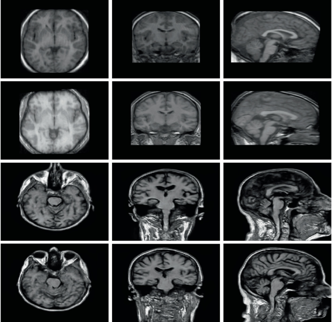 Non-reference Quality Assessment for Medical Imaging: Application to ...