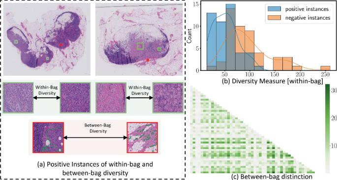 DGR-MIL: Exploring Diverse Global Representation in Multiple Instance Learning for Whole Slide ...