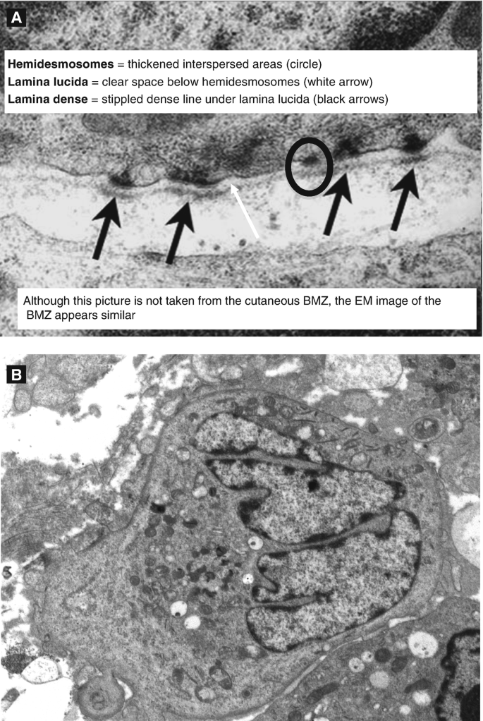 Dermoscopy and Electron Microscopy | SpringerLink