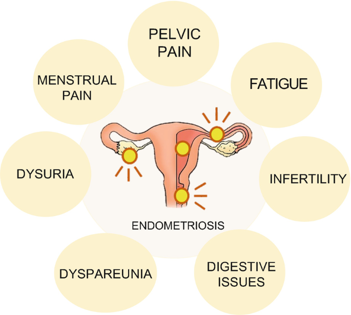 The Association of Endometriosis with Mental Health and Disorders ...