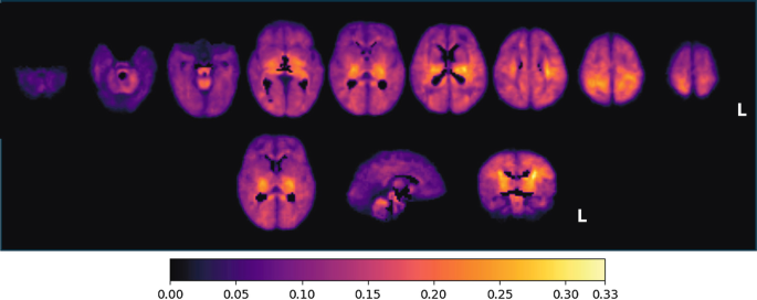 Linking Deep Learning and MRI to Brain Disorders | Springer Nature Link