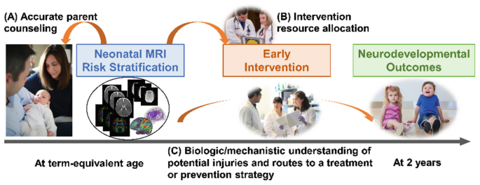MRI and Artificial Intelligence for Early Prediction of ...