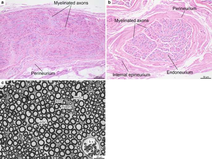 Nerve Histology and Physiology in Health and Disease | SpringerLink