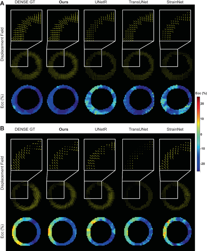 LaMoD: Latent Motion Diffusion Model for Myocardial Strain Generation ...