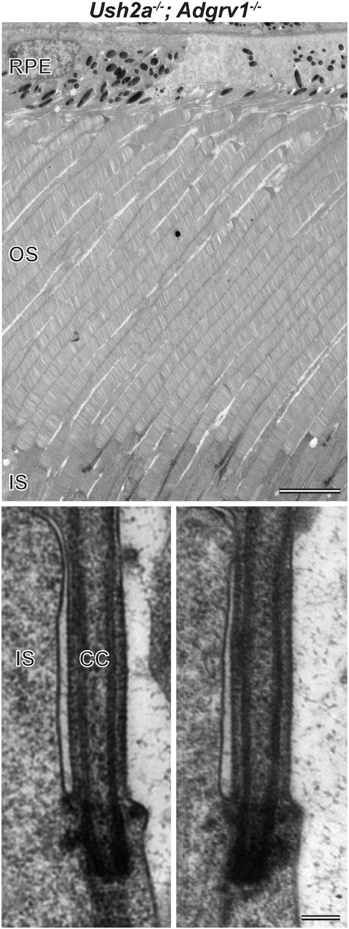 Loss of Usher II Proteins in Mice Does Not Affect Photoreceptor ...