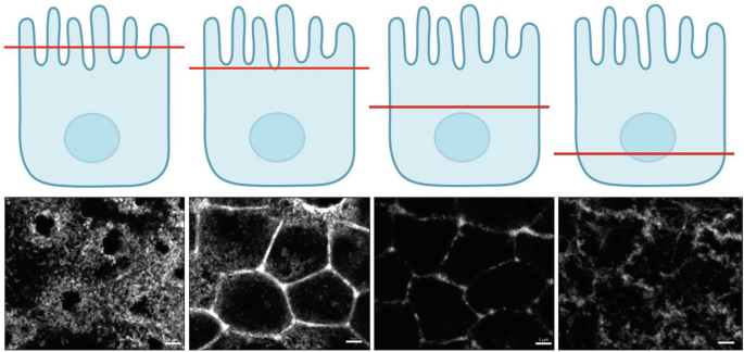 The Importance of Differentiated RPE Cultures for studying Cell ...
