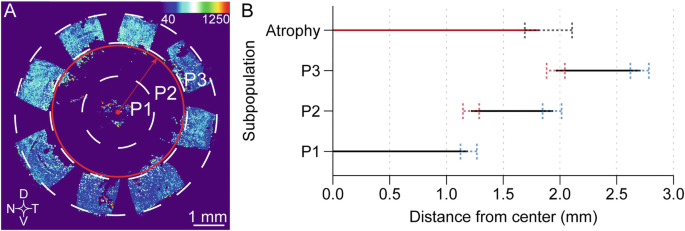 Classifying Mouse RPE Morphometric Heterogeneity Using REShAPE: An AI ...