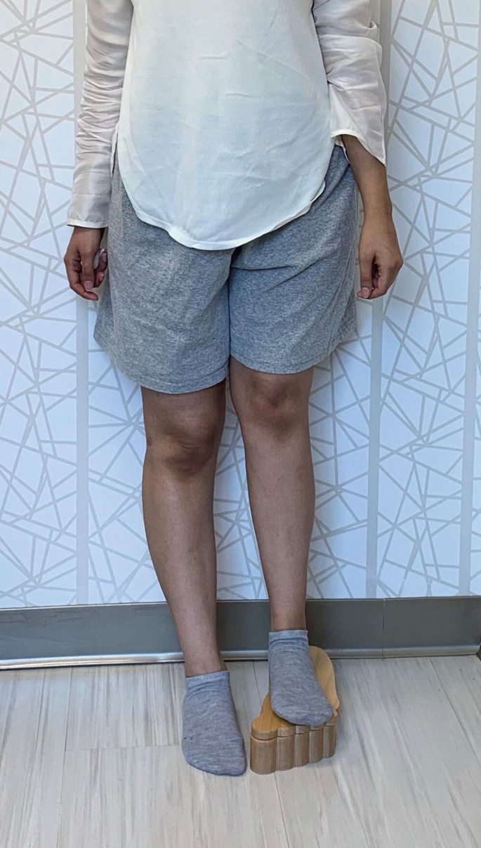 Staged Total Hip Arthroplasty and Femoral Lengthening for Chronic ...