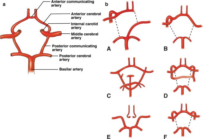 Intracranial Internal Carotid Artery and Vertebrobasilar System ...