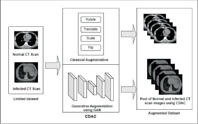 CDAC: Collaborative Data Augmentation for the Classification of Chest ...