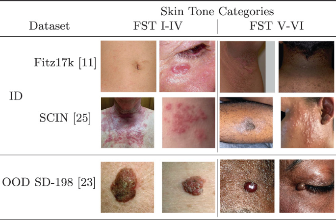 Impact of Skin Tone Diversity on Out-of-Distribution Detection Methods ...
