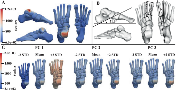Capturing Complexity of the Foot Arch Bones: Evaluation of a ...