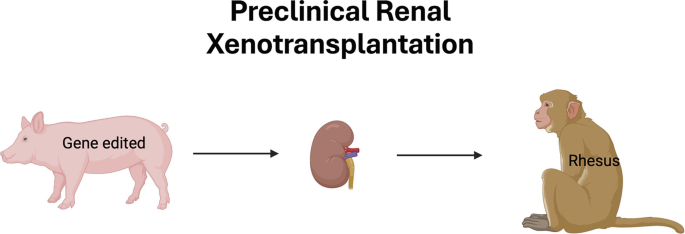 Xenotransplantation Springer Nature Link