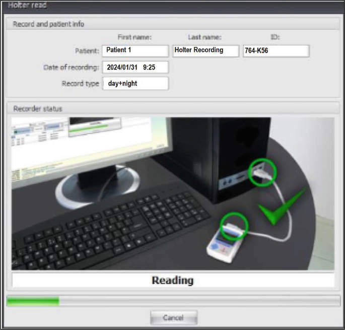 Technical Principles of Holter Monitoring | SpringerLink