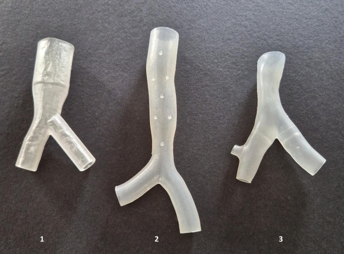 Three-Dimensional-Printed and Bioabsorbable Stents | SpringerLink