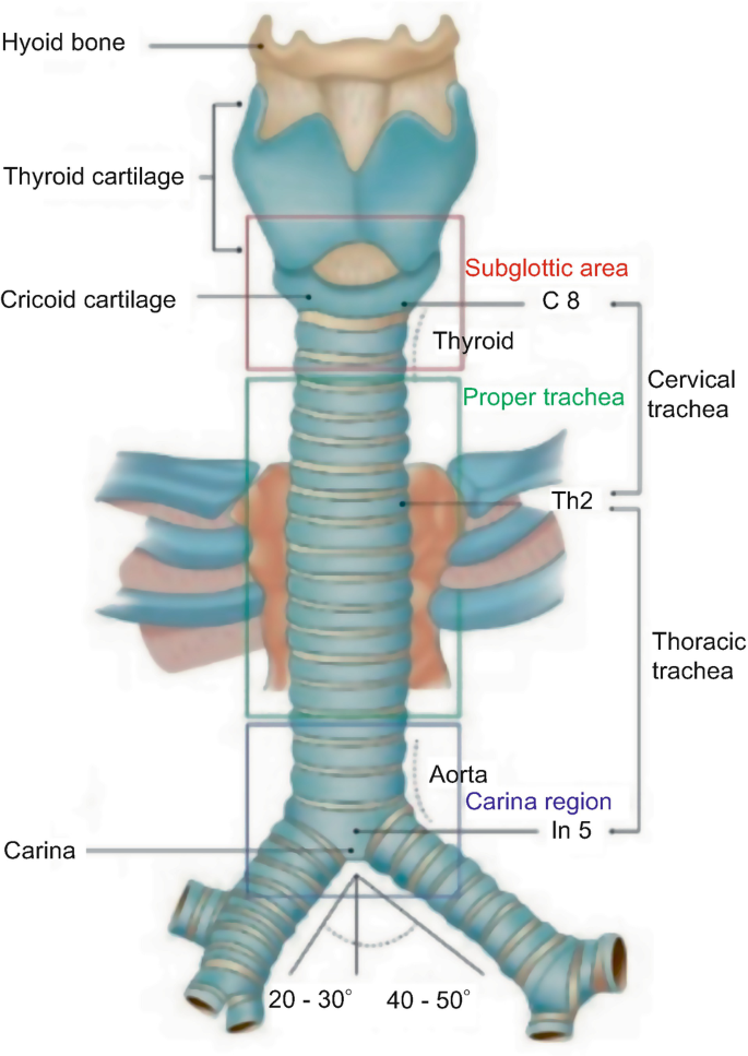Resection and Reconstruction of Central Airways | Springer Nature Link