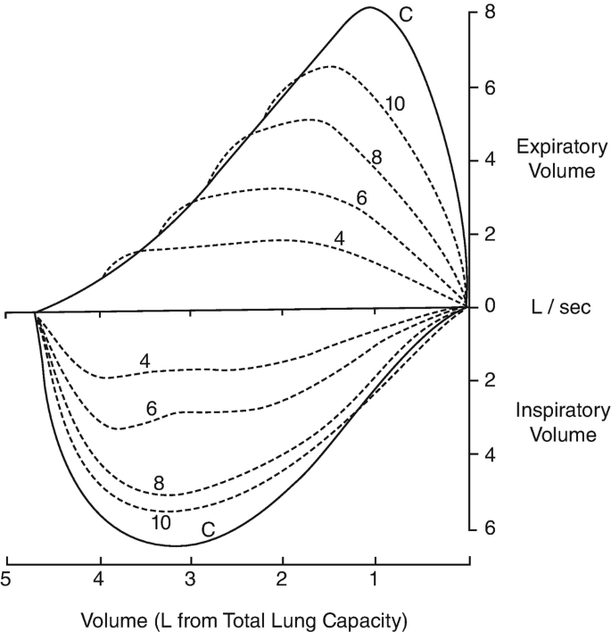 Physiology of Fixed Airway Obstruction | SpringerLink