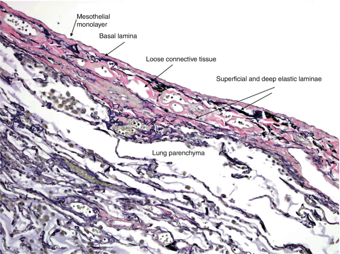 Pleural Anatomy And Fluid Analysis Springer Nature Link