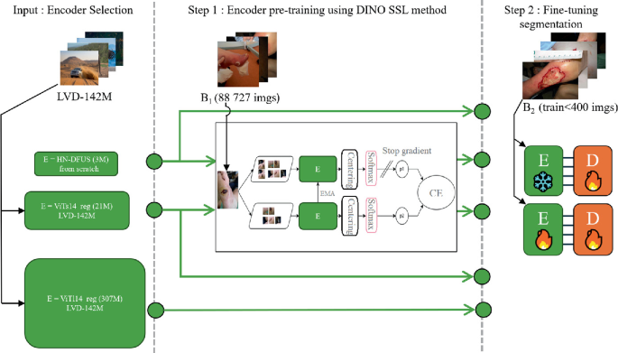 SSL Based Encoder Pretraining for Segmenting a Heterogeneous Chronic Wound Image Database with ...