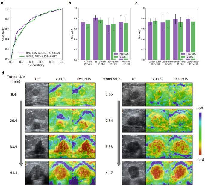 Virtual Elastography Ultrasound via Generative Adversarial Network and ...