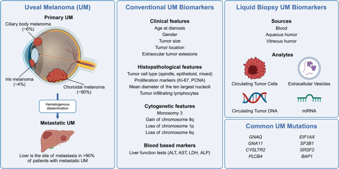 Biomarkers in Uveal Melanoma: Current and Emerging Applications | SpringerLink