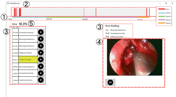 Automated Feedback System for Surgical Skill Improvement in Endoscopic ...