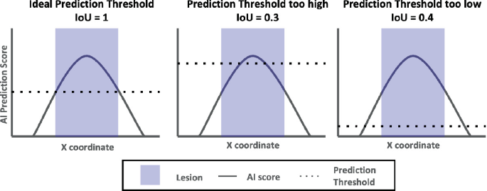 From Pixel Scores to Clinical Impacts: The Implicit Choices in FROC ...