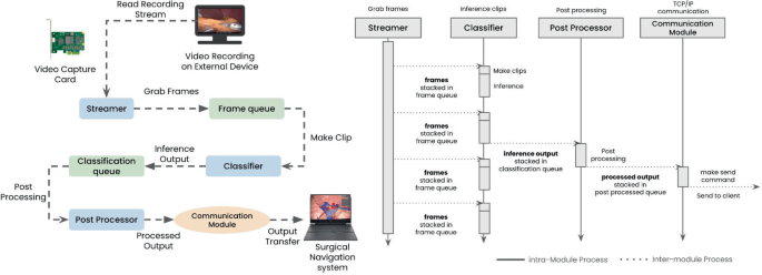 SP-NAS: Surgical Phase Recognition-Based Navigation Adjustment System for Distal Gastrectomy ...