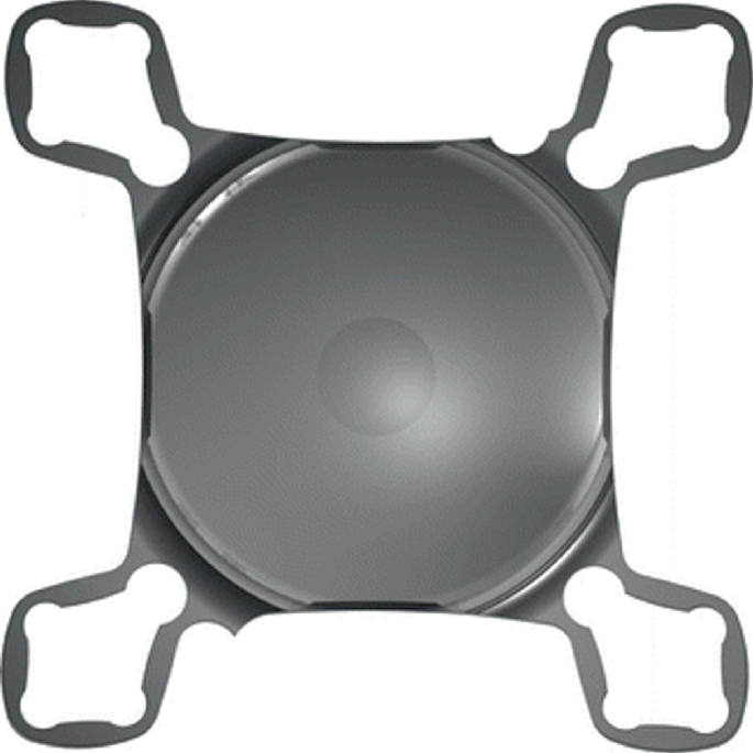 Scharioth Macula Lens | SpringerLink