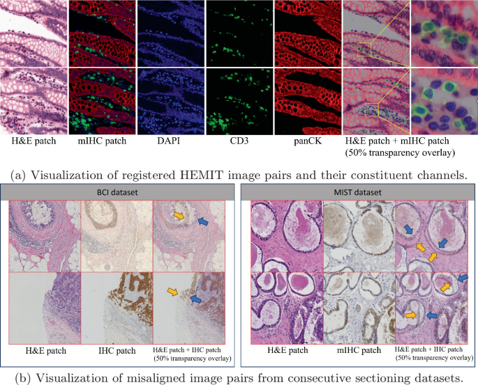 HEMIT: H&E to Multiplex-Immunohistochemistry Image Translation with ...