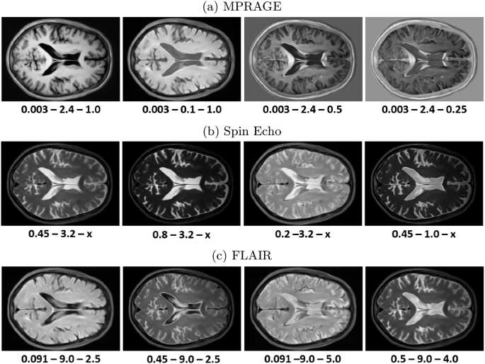 Physics-Informed Latent Diffusion for Multimodal Brain MRI Synthesis ...