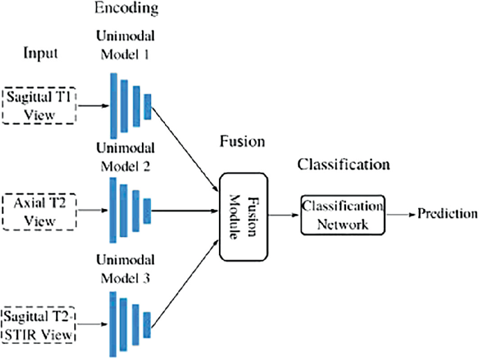 RSNA 2024: Multi-view Quantum Deep Learning Model for Degenerative ...