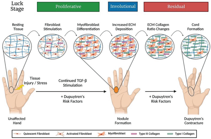 Pathophysiology and Genetic Considerations | SpringerLink