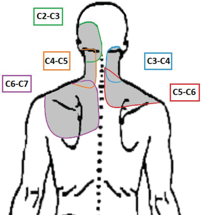 Musculoskeletal Masqueraders of Spine Pain | SpringerLink