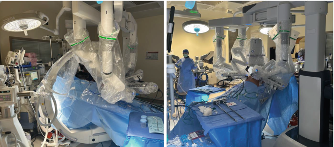 Robotic Cholecystectomy | SpringerLink
