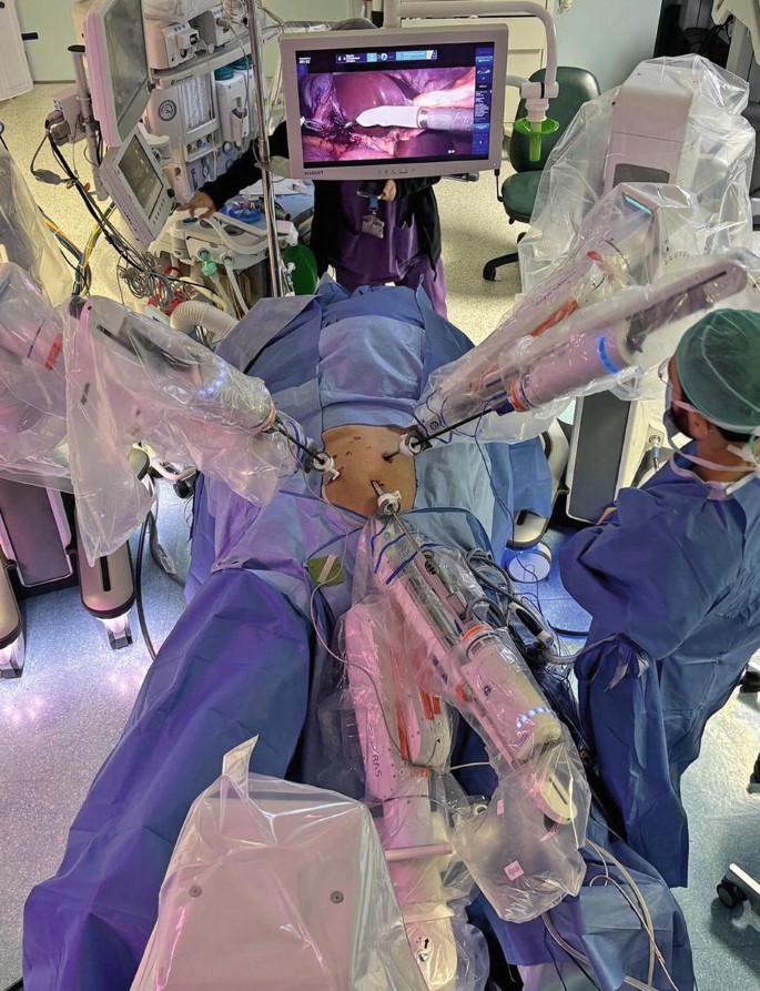 The Hugo RASTM | SpringerLink