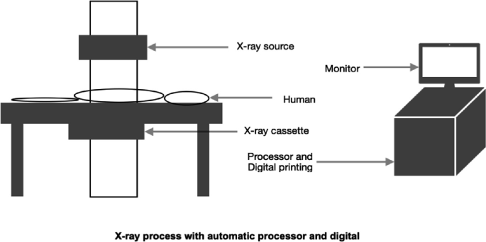 Design and Development of an X-ray Film Dryer for the Rural Market ...