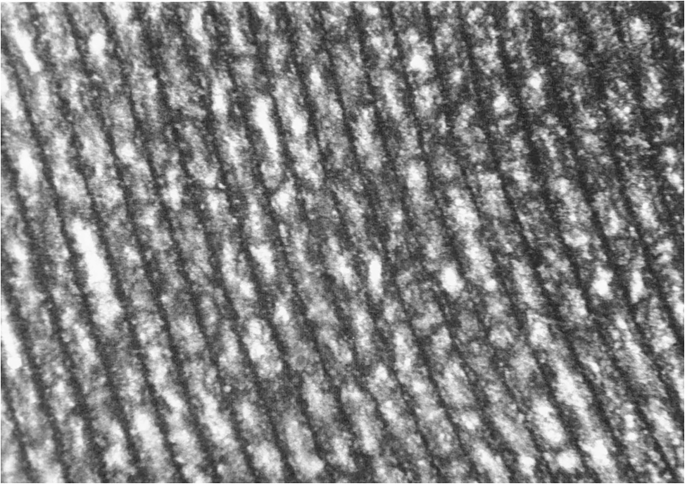 Anatomy and Physiology of the Human Eye | Springer Nature Link