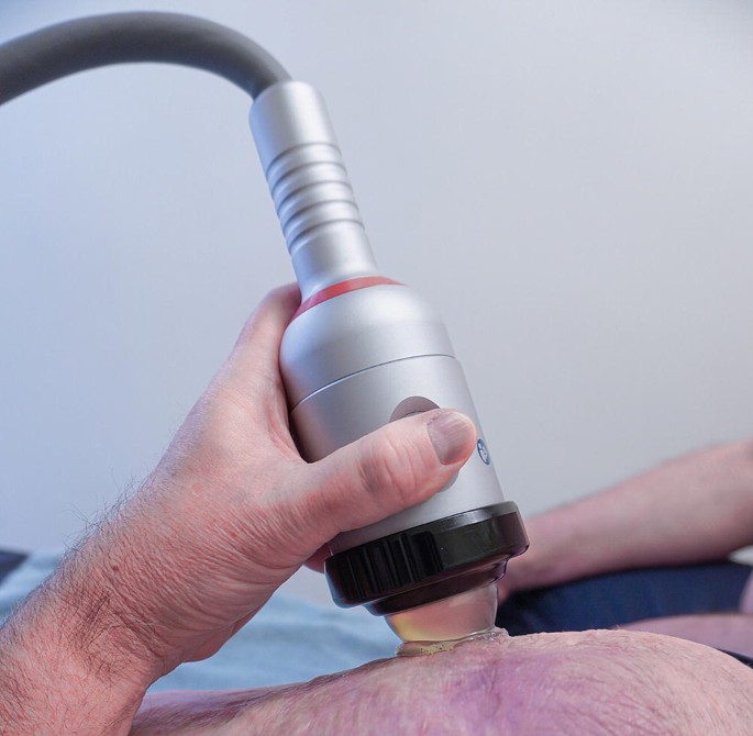 Shock Wave Therapy for Wound Healing and Burn Scar Treatment | SpringerLink