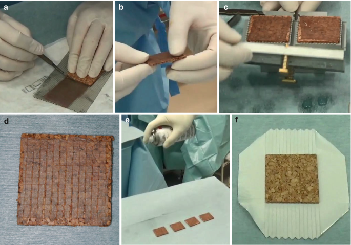 MEEK Micrografting | Springer Nature Link